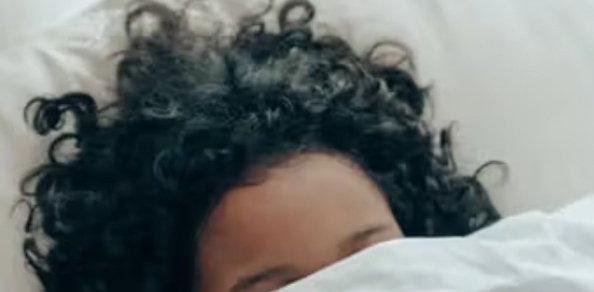 Understanding Nocturnal Lagophthalmos: Why Some People Sleep with Eyes ...