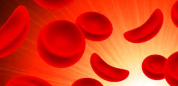 New drug offers hope for longer life in sickle cell disease patients ...